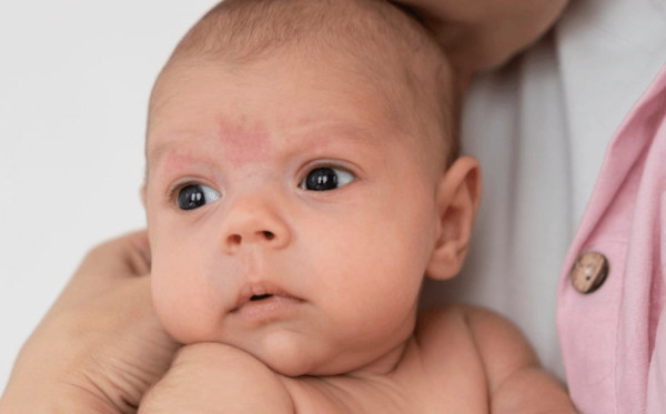Pipi Bayi Merah-Merah? Belum Tentu Karena Alergi! Simak Penjelasannya ...