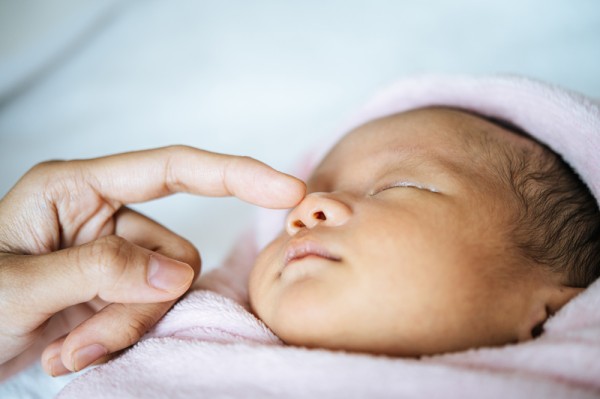 Bayi Kuning, Kenali Penyebab & Cara Mengobatinya - Tentang Anak